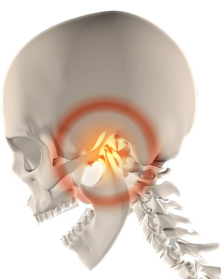 TMJ Symptoms & Treatment Florence SC | Jaw Pain Darlington