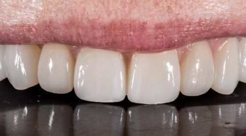 Cosmetic Dentistry Smile Gallery with Before & After Photos